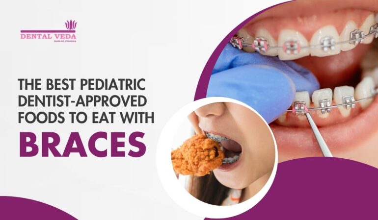 The Best Pediatric Dentist-Approved Foods to Eat with Braces
